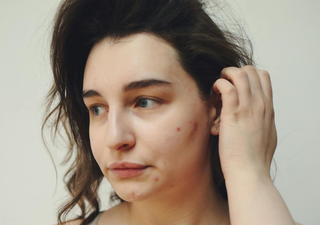 5 Stressed Skin Solutions To Soothe And Restore Your Complexion | Face ...